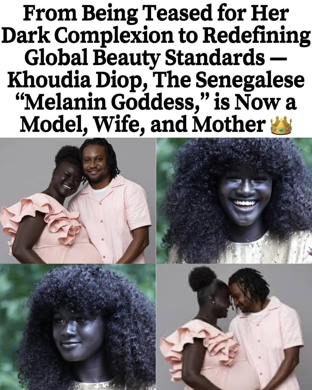 From Being Teased for Her Dark Complexion to Redefining Global Beauty ...