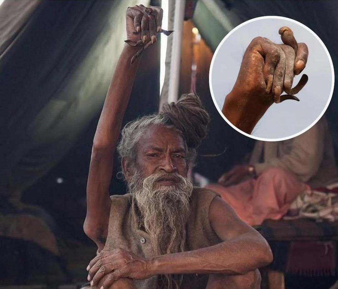 Meet The Man Who Has Kept His Arm Raised Since 1973 — For World Peace ...